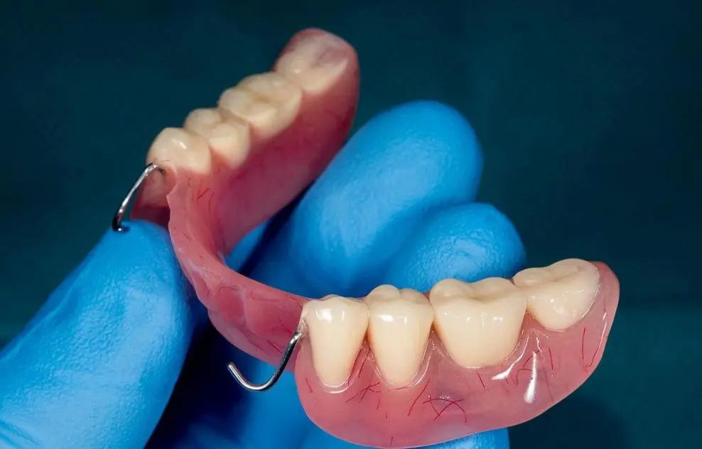 How to Choose the Most Comfortable Dentures: Key Factors You Need to ...